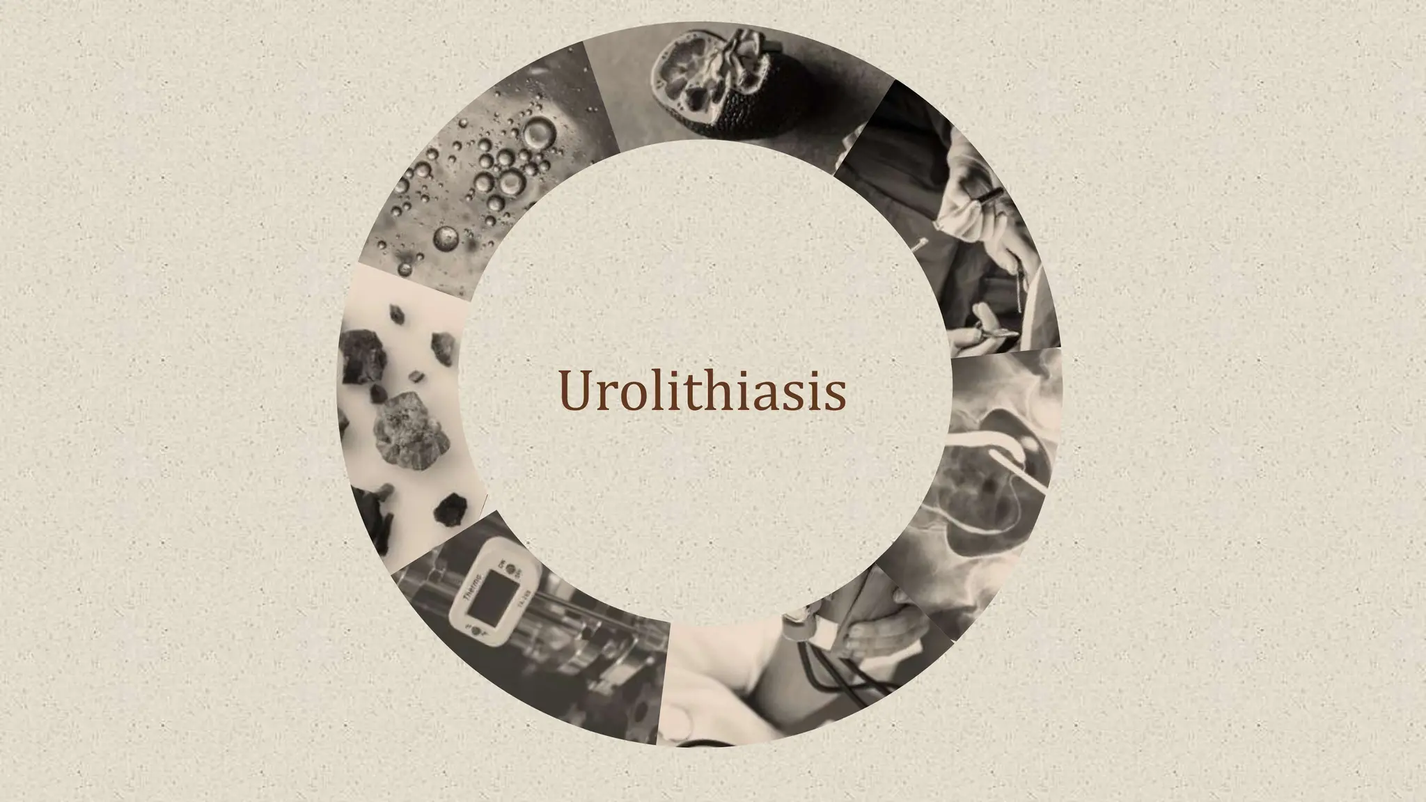 Laporan Kasus Vesicolithiasis di Rumah Sakit | PPTX