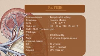 Laporan Kasus Vesicolithiasis di Rumah Sakit | PPTX