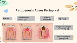 LAPORAN KASUS ABSES PERIAPIKAL drg Rhian Surya.pptx
