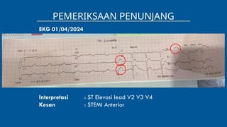 Laporan Kasus ACS STEMI - Imam Rahmatullah Maulana Pasha.pptx