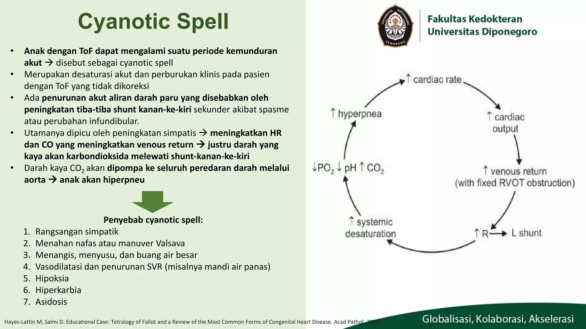 laporan kasus anestesi TOF.pptx
