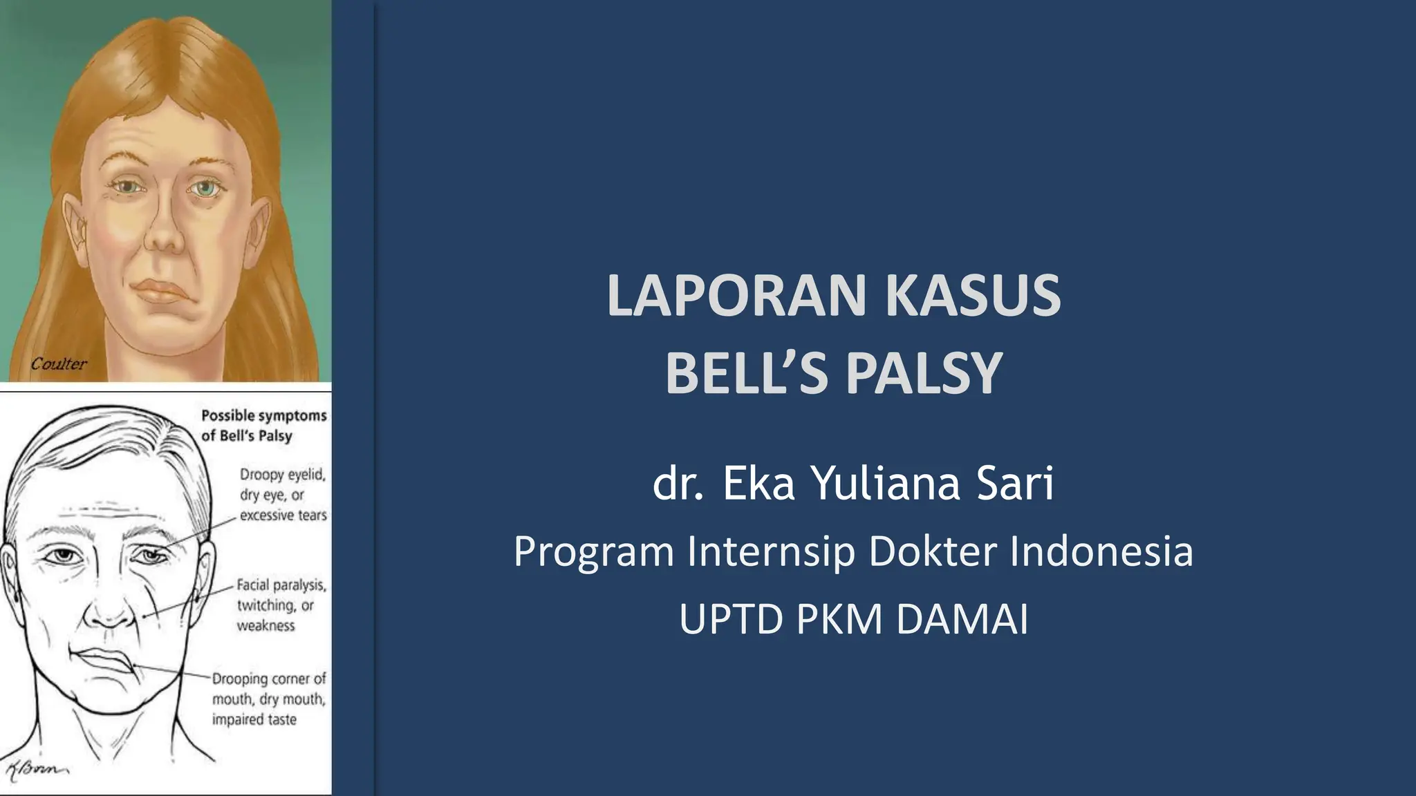 LAPORAN KASUS pada pasien bells_palsy di uptd pkm damai | PPT