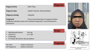 Laporan kasus bels palsy di uptd puskesmas | PDF