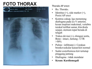 Laporan Kasus DVT.pptx