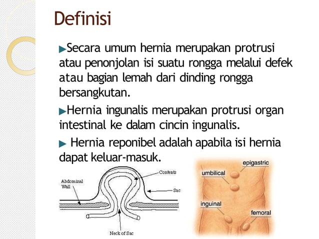 Laporan Kasus Hernia Inguinalis dextra.pptx