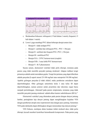Laporan Kasus Multiple Ventricle Extra Systole (mVES) | PDF