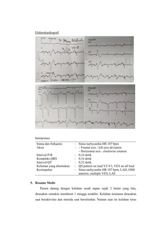 Laporan Kasus Multiple Ventricle Extra Systole (mVES) | PDF
