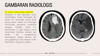 LAPORAN KASUS PADA PASIEN SROKE NON HEMORAGIC DENGAN DM TIPE 2.pdf
