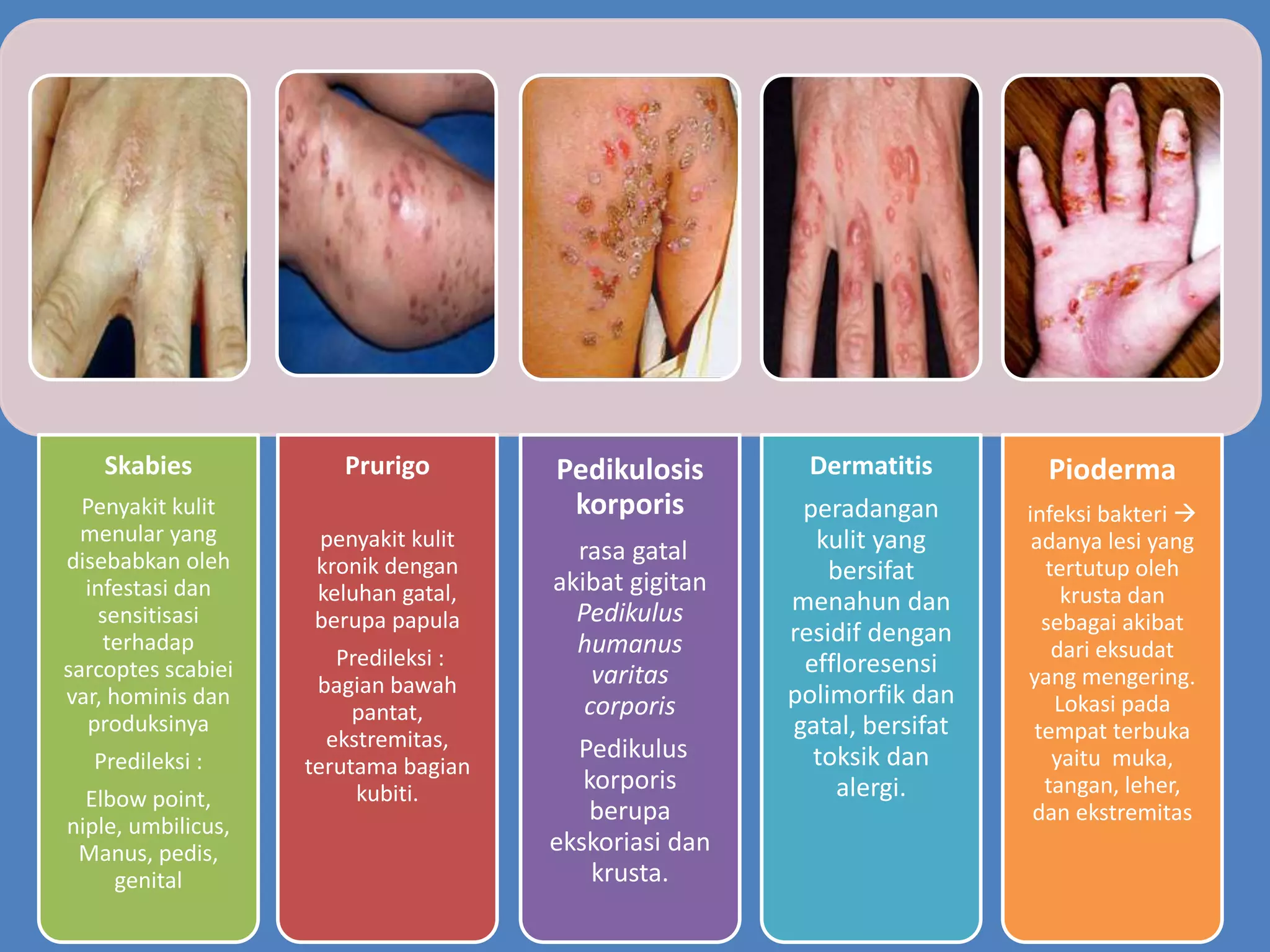 Laporan kasusScabies | PPTX