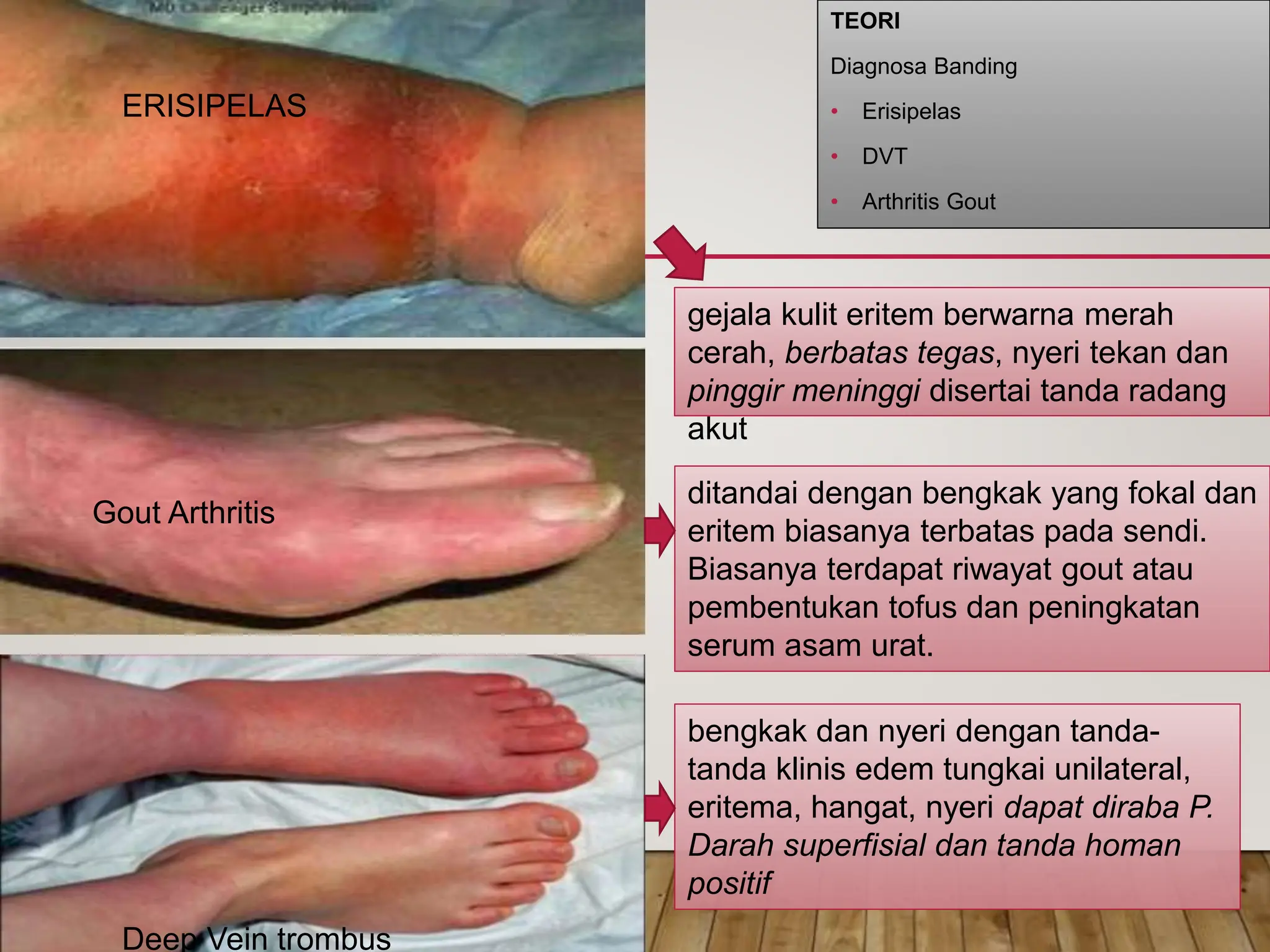 LAPORAN KASUS SELULITIS RSUD WAMENA_075010-1.pptx