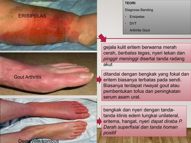LAPORAN KASUS SELULITIS RSUD WAMENA_075010-1.pptx