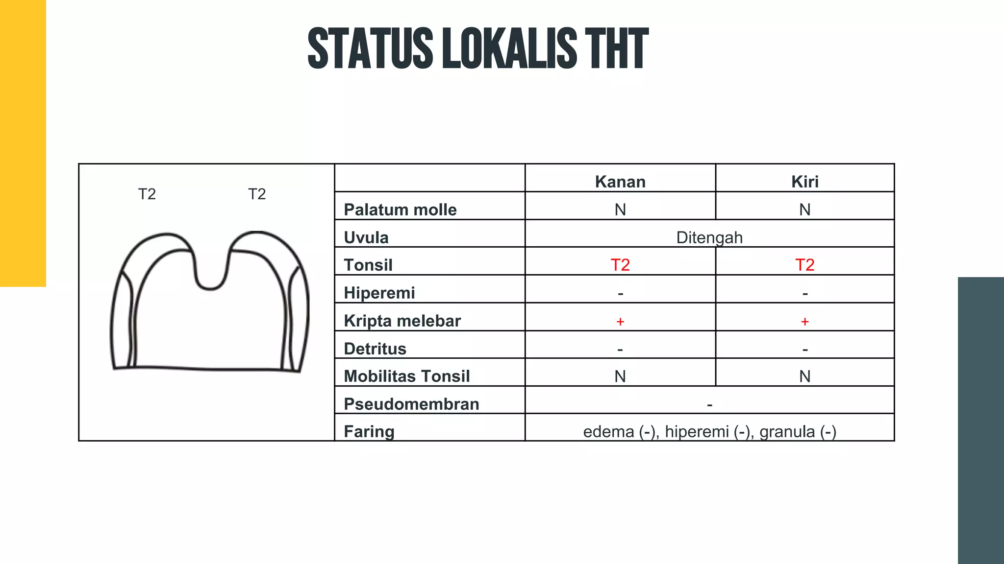 Laporan Kasus THT Anindya.pptx
