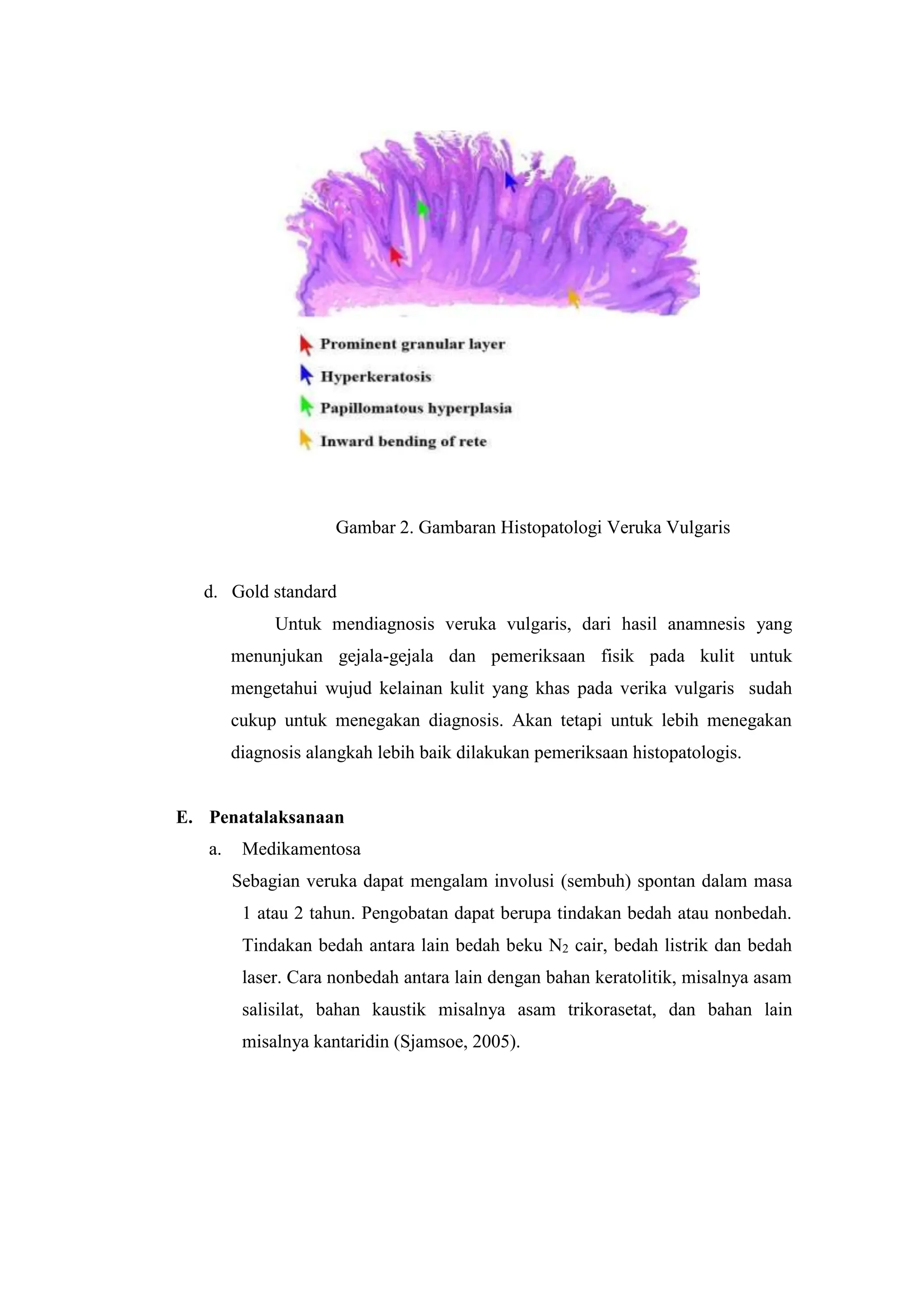 LAPORAN KASUS VERUKA VULGARIS FATTIA PRATIWI 22360180.docx