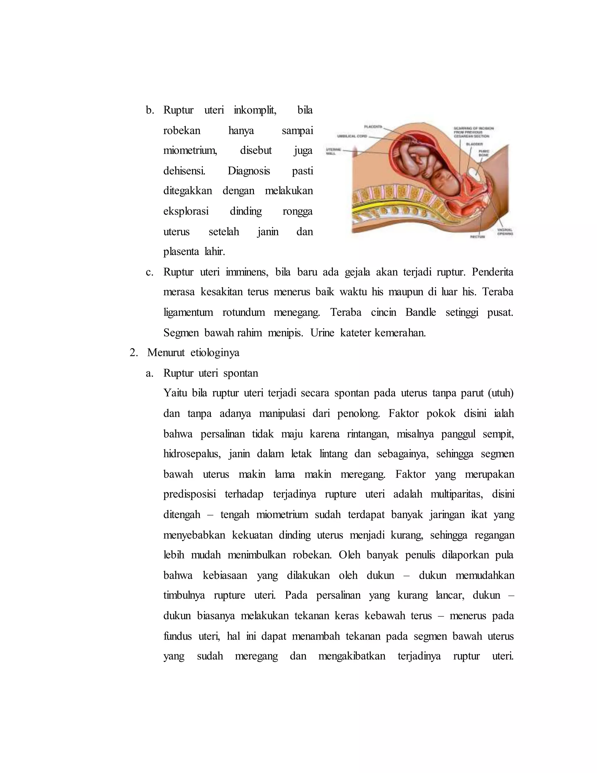 ASKEB Ruptur Uteri AKBID HAFSHAWATY ZAINUL HASAN GENGGONG PROBOLINGGO ...