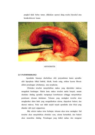 LAPORAN_PENDAHULUAN_APENDISITIS.docx