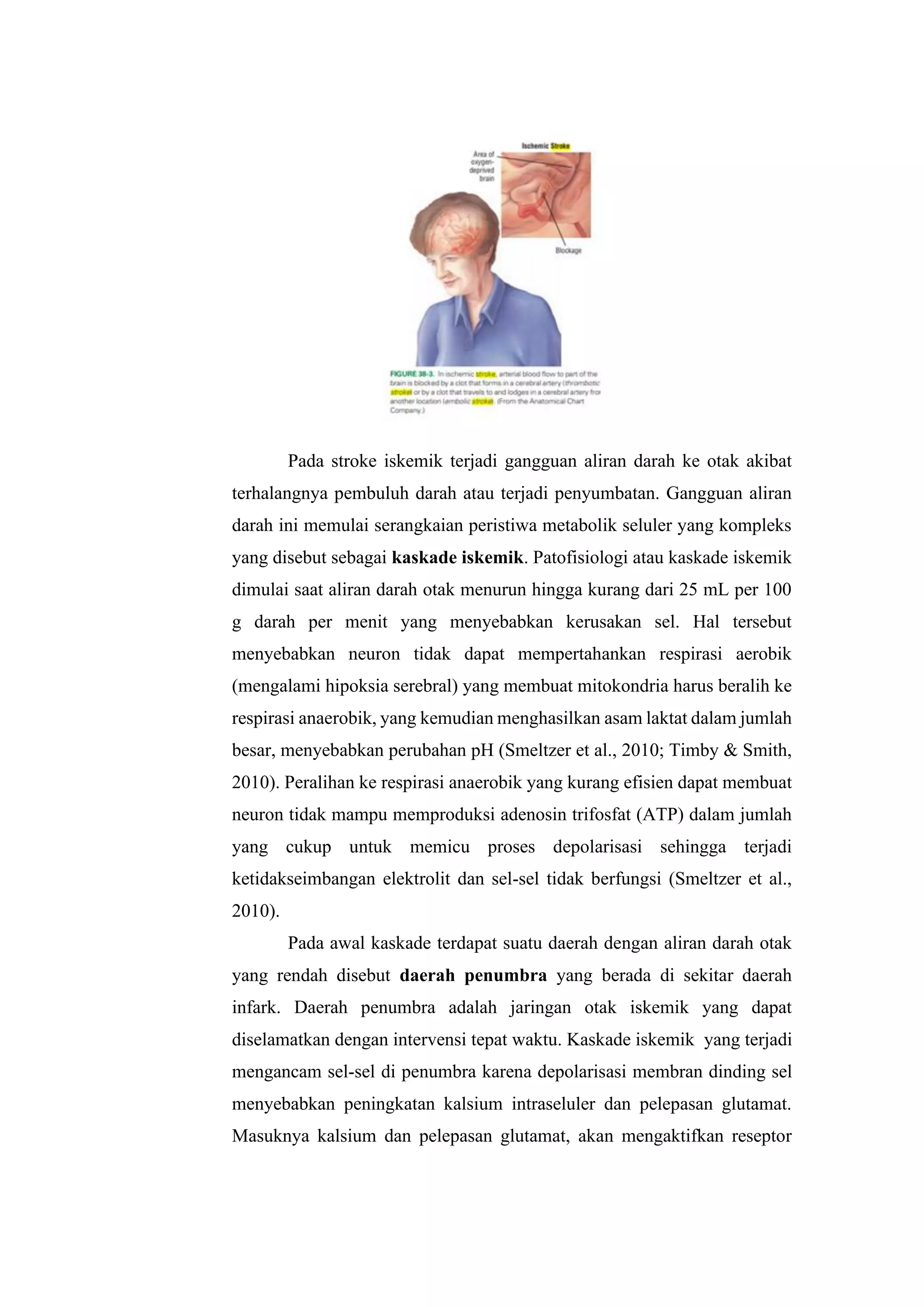 Laporan Pendahuluan Tentang Stroke Iskemik.pdf