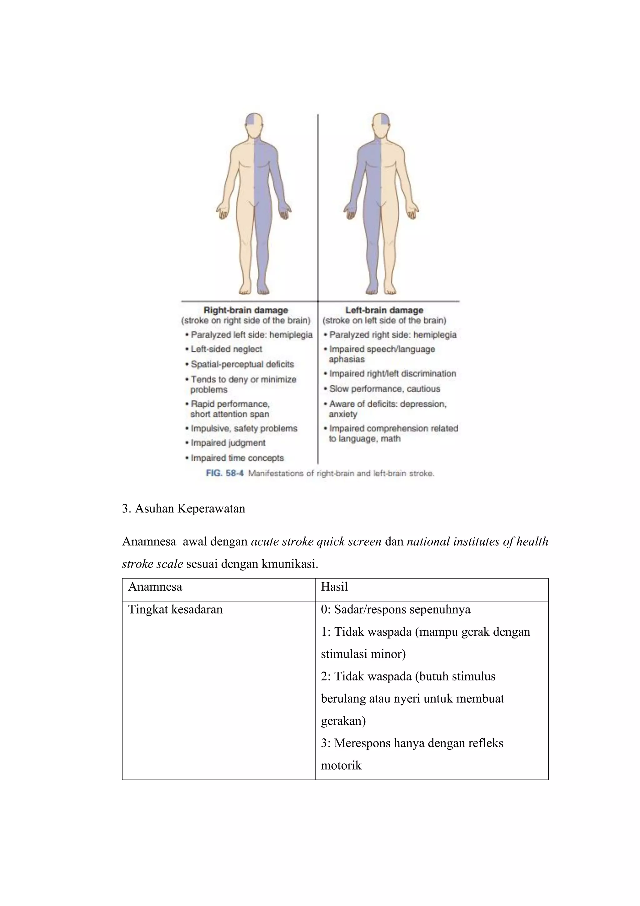 Laporan Pendahuluan Tentang Stroke Iskemik.pdf