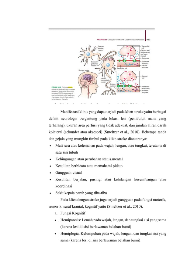 Laporan Pendahuluan Tentang Stroke Iskemik.pdf