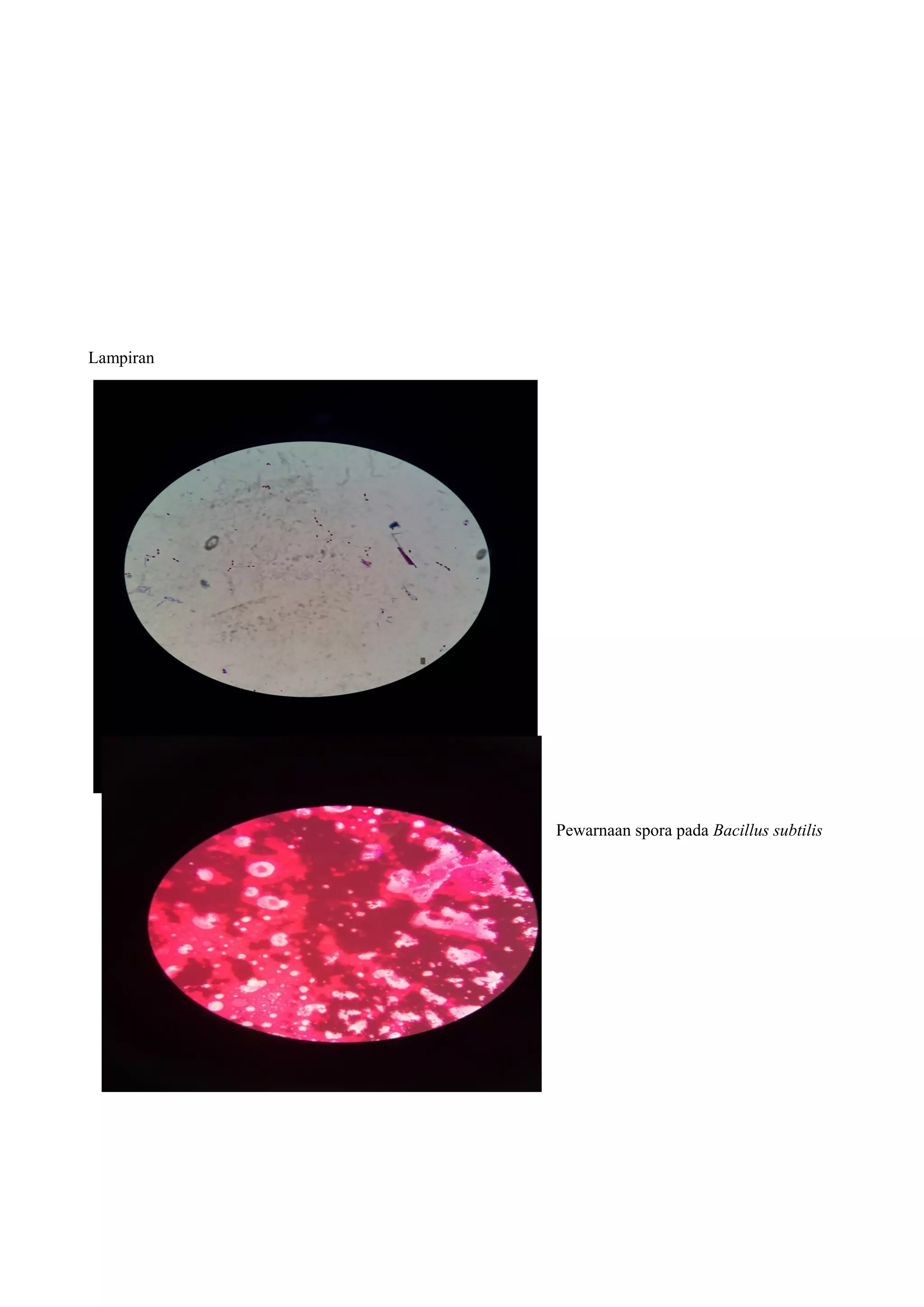 LAPORAN RESMI PRAKTIKUM MIKROBIOLOGI I PEWARNAAN SPORA DAN KAPSUL PADA ...