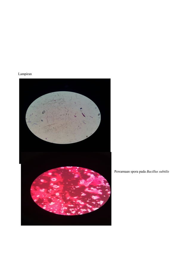LAPORAN RESMI PRAKTIKUM MIKROBIOLOGI I PEWARNAAN SPORA DAN KAPSUL PADA ...