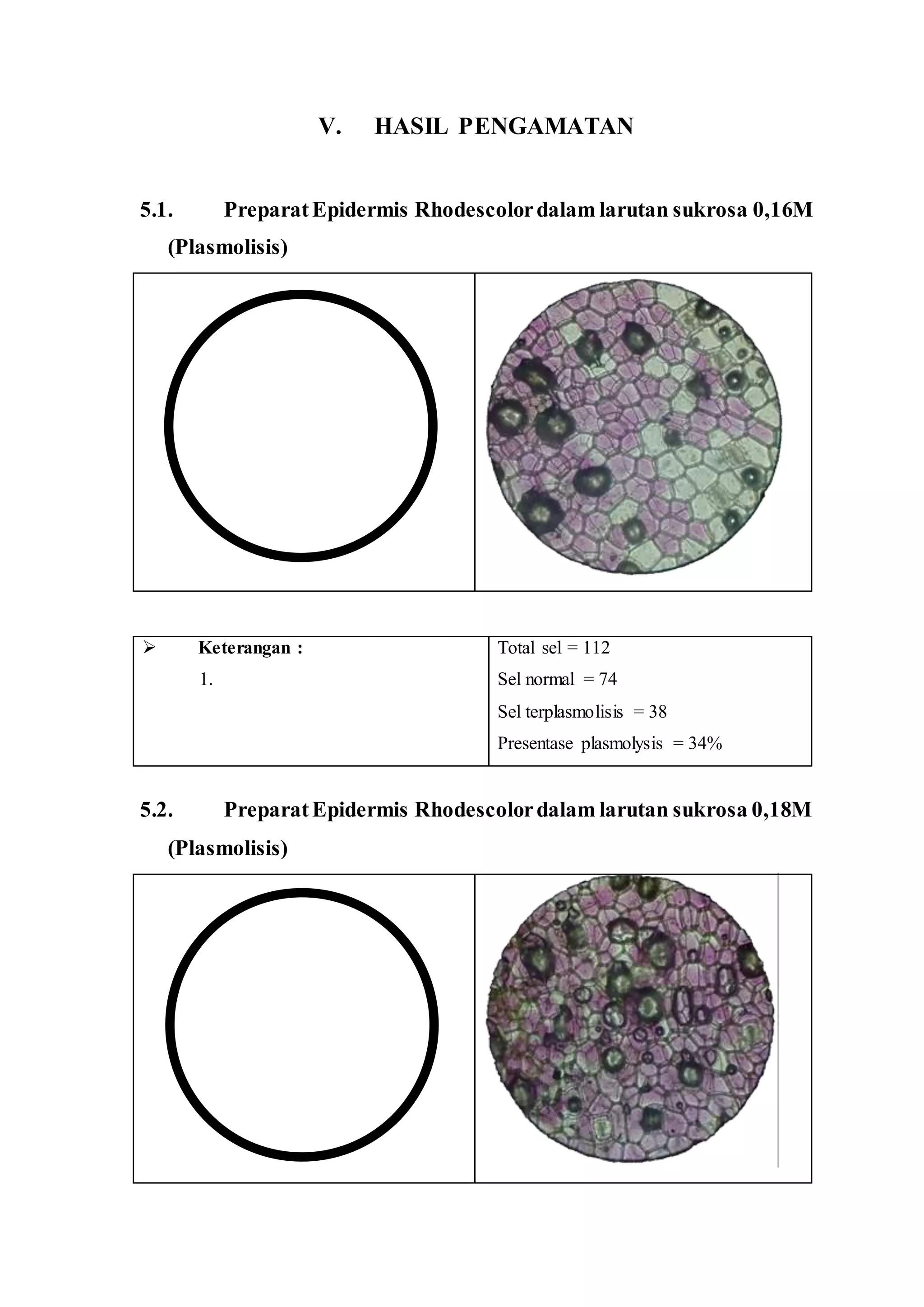 Laporan Resmi Praktikum Biologi Peristiwa Plamolisis dan Deplasmolisis | DOCX