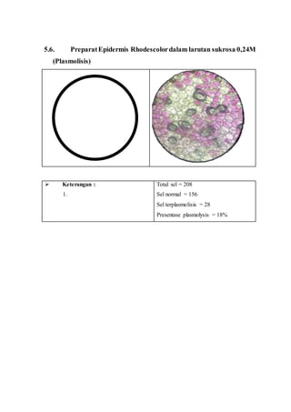 Laporan Resmi Praktikum Biologi Peristiwa Plamolisis dan Deplasmolisis | DOCX