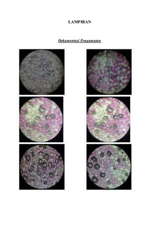 Laporan Resmi Praktikum Biologi Peristiwa Plamolisis dan Deplasmolisis | DOCX