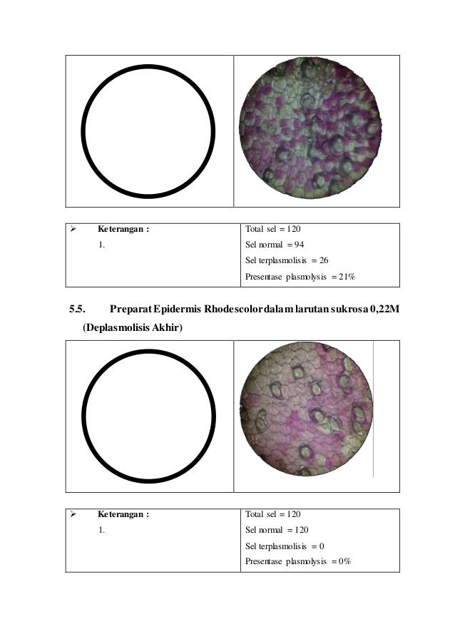 Laporan Praktikum Plasmolisis Dan Krenasi – Beinyu.com