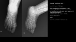 Laporan Stase Muskuloskeletal 5 Juni 2024.pdf
