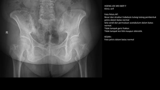 Laporan Stase Muskuloskeletal 5 Juni 2024.pdf