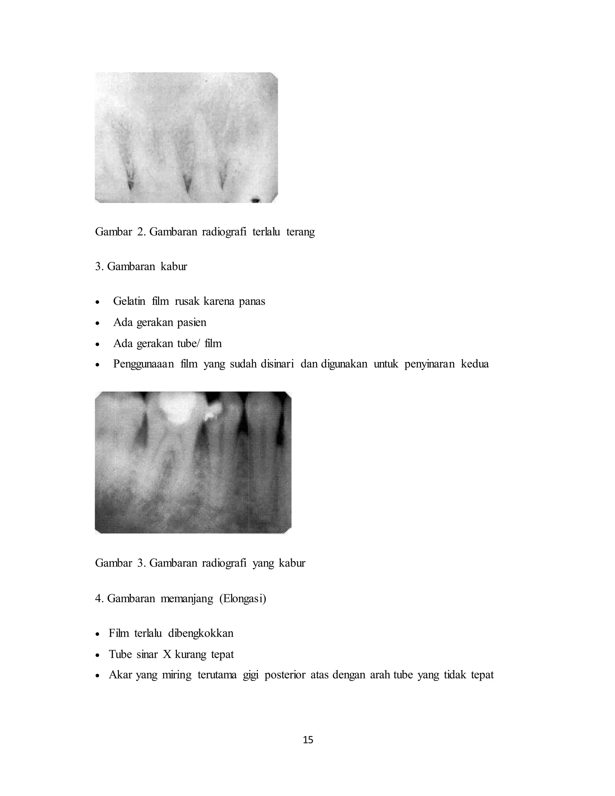 Laporan tutorial Radiografi Kedokteran Gigi | DOCX