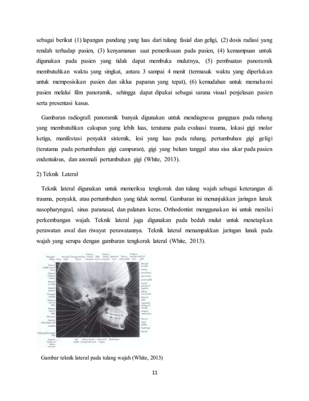 Laporan tutorial Radiografi Kedokteran Gigi | DOCX