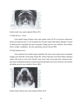 Laporan tutorial Radiografi Kedokteran Gigi | DOCX