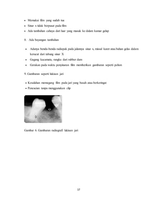 Laporan tutorial Radiografi Kedokteran Gigi | DOCX