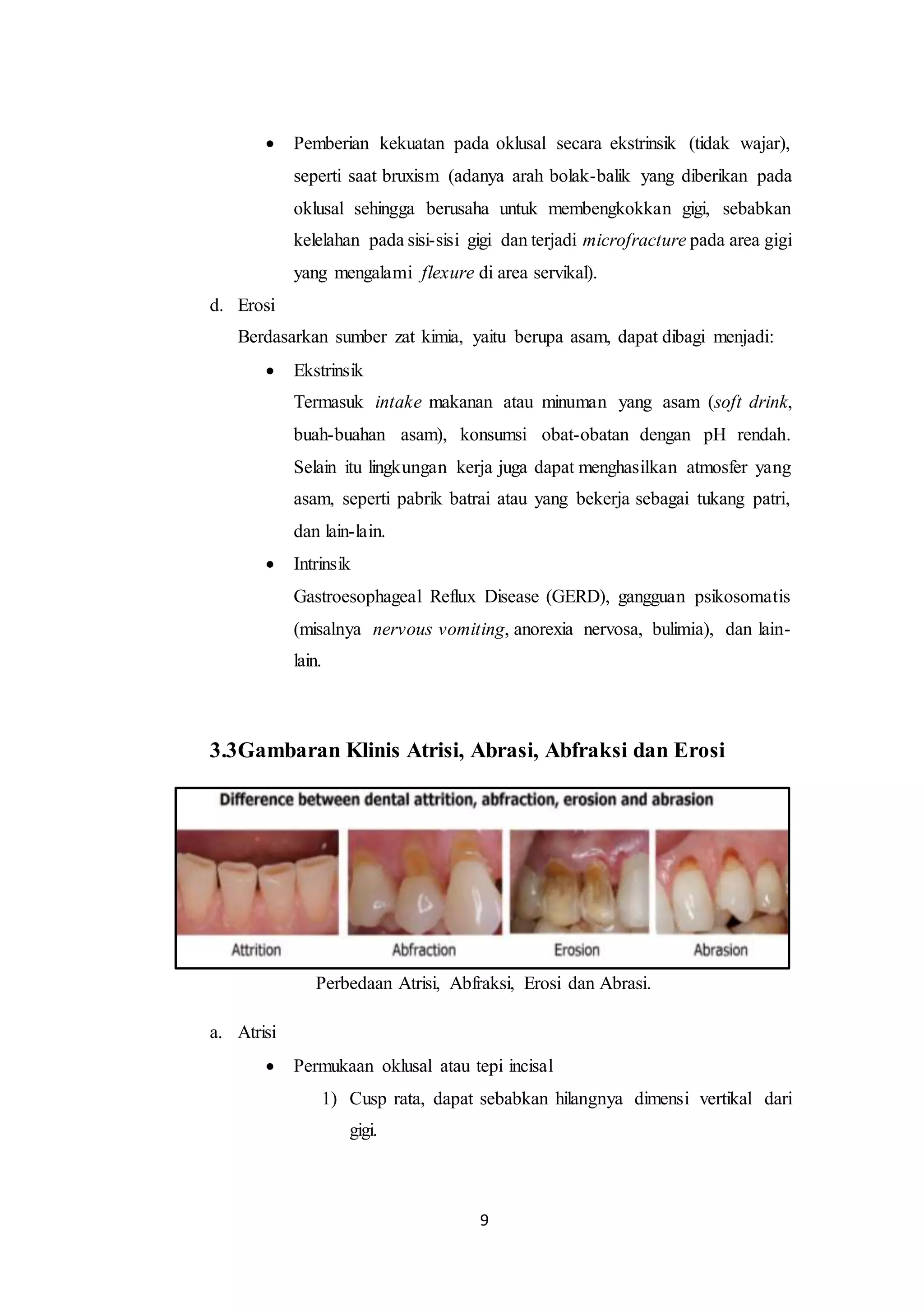 Laporan Tutorial Atrisi, Abrasi, Abfraksi & Erosi | DOCX