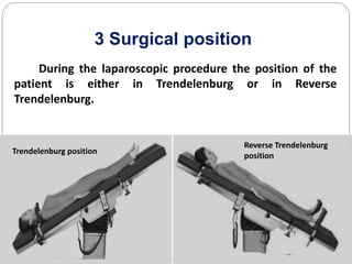 laprascopy.pptx