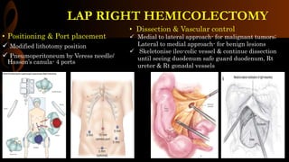 LAP RIGHT HEMICOLECTOMY-STEP BY STEP Operative Surgery.pptx