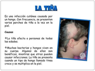 La problemática de la sobrepoblación canina en la salud pública | PPT