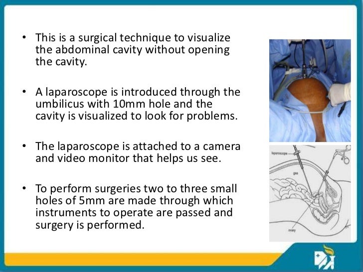 Laproscopic Gynecological Surgery