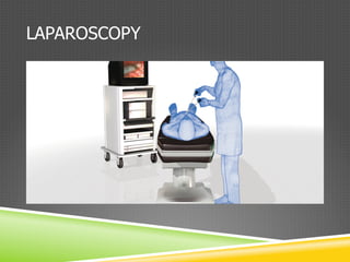 Laproscopy in gynecology oncology | PDF