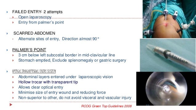 Laproscopy And Hysteroscopy In Gynecology No Video