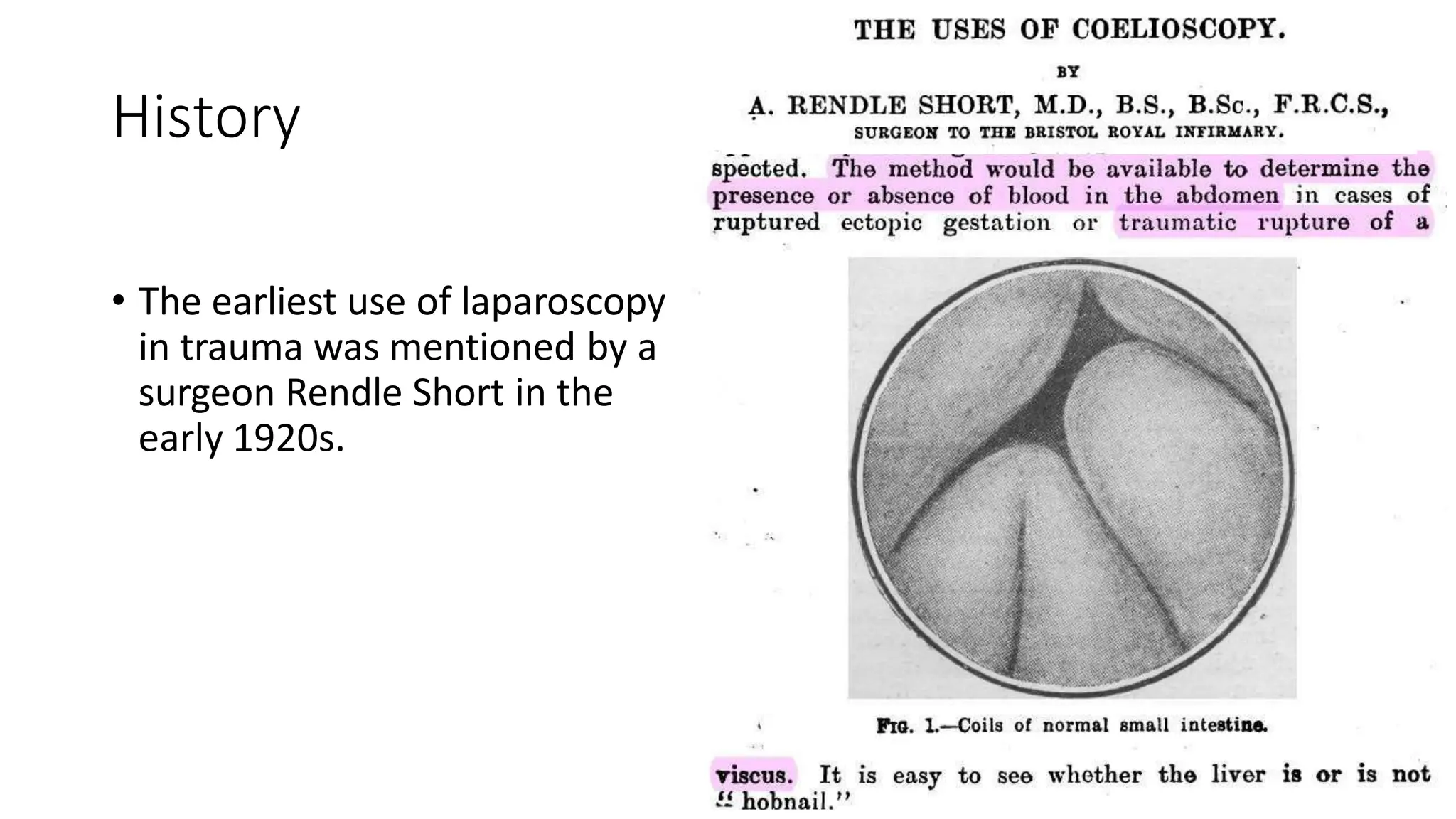 Laproscopy approach In abdominal Trauma.pptx