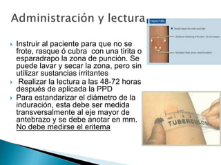 La prueba de la tuberculina | PPTX