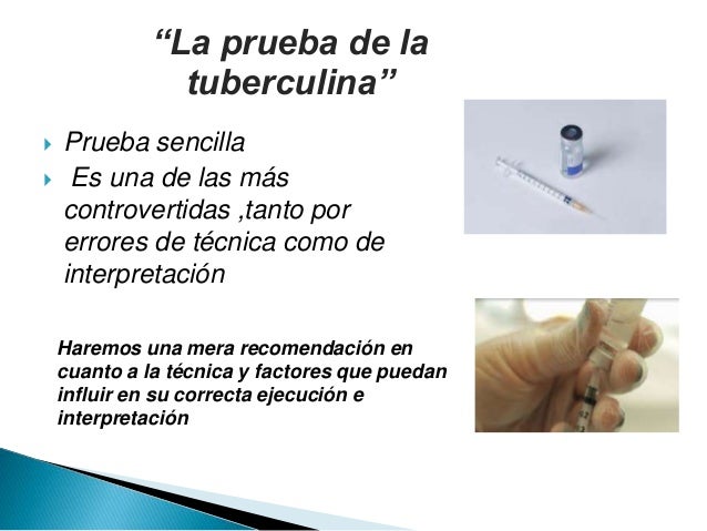 La prueba de la tuberculina