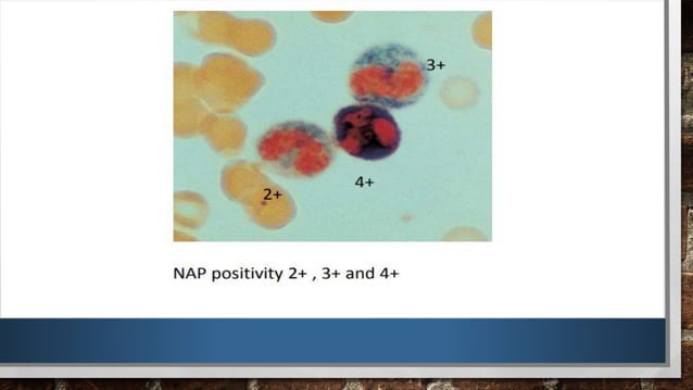 Lap score | PPTX | Blood Disorders | Diseases and Conditions