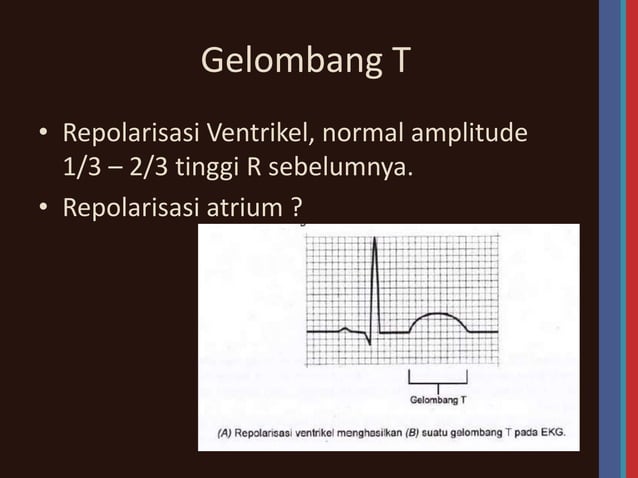 Total AV Block .pptx