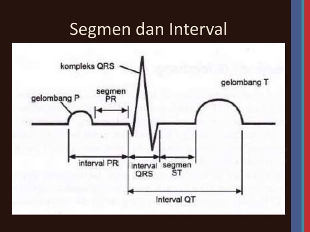 Total AV Block .pptx