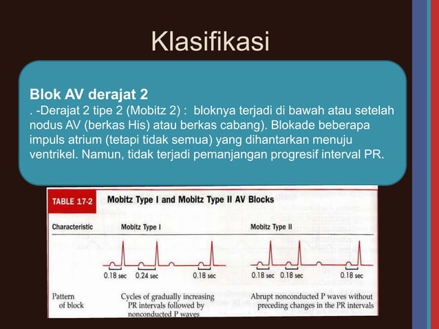 Total AV Block .pptx