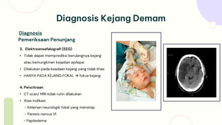 lapsus kejang demam sederhana internship | PPTX