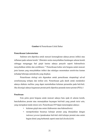 bph dan vesiclithiasis | DOC